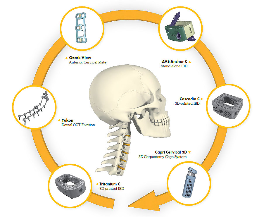 Spine | Stryker Spine | Stryker